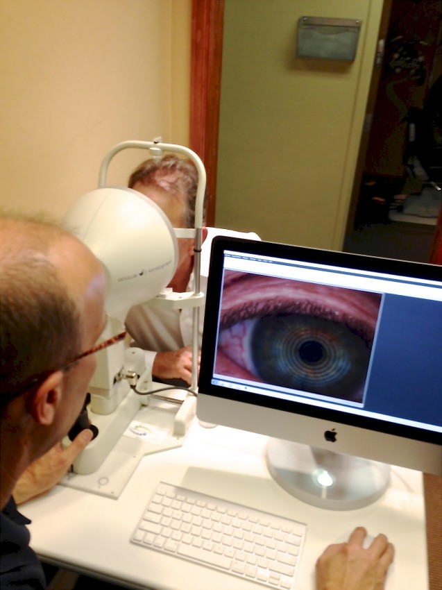 Oculus Keratograph Install - Corneal Topography | Blue River Medical, Inc.