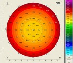 Calculation of Corneal Power - Oculus Pentacam | Blue River Medical, Inc.