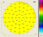 Calculation of Corneal Power - Oculus Pentacam | Blue River Medical, Inc.